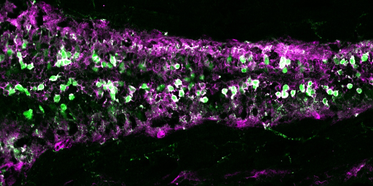 Neural stem cells and repair research focus - LINDSEY LAB