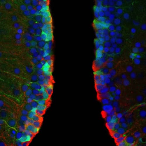 Laboratory of Neural Stem Cell Plasticity & Regeneration - LINDSEY LAB